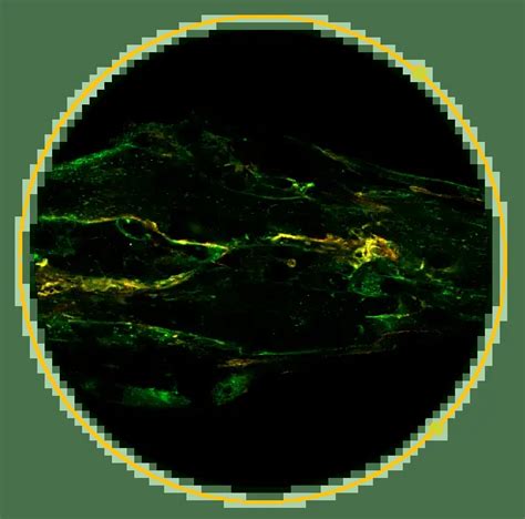 Target Identification And Validation