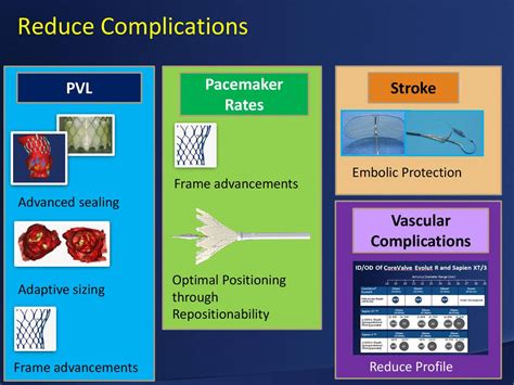 Tavr How We Continue To Refine The Technology And Improve The Results Ppt Download