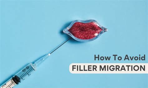 Lip Filler Migration Causes And Prevention Vie Aesthetics