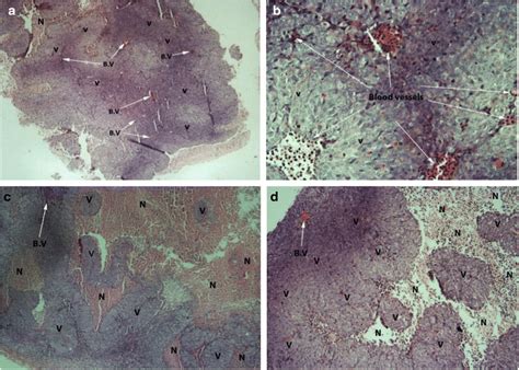Cross Section At Tumor Tissue The Tumor Cross Sections Were Stained Download Scientific