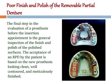 Insertion And Postinsertion Of Removable Partial Denture Ppt