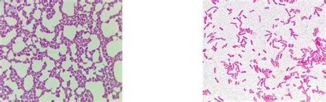 Bacterial Characterization Using Gram Staining Figure A The