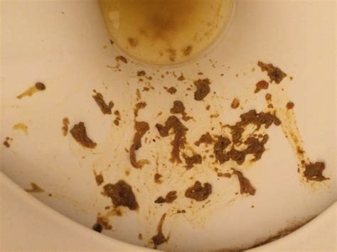 Parasite Identification Help Photos At Parasites Support Forum Alt