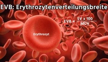 Evb Erythrozytenverteilungsbreite Ist Ein Blutwert