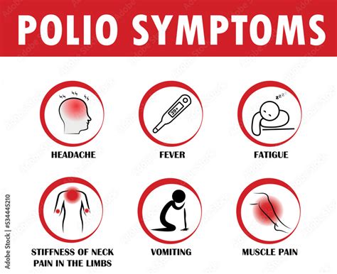 Polio Symptoms Virus Poliomyelitis Stock Vector Adobe Stock