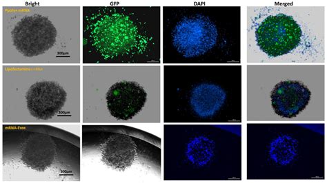 Microscopic Fluorescence Images Of 3D Spheroids B16F10 Cells
