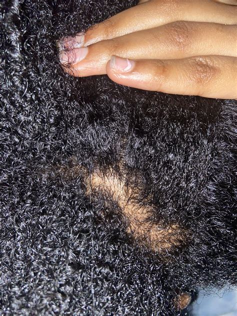 Pretty Sure Im Balding From Stress And Need Suggestions And Uplifting