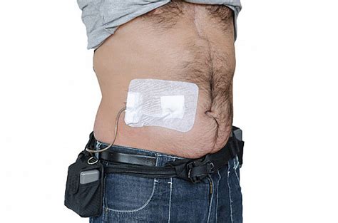 Women Less Likely Than Men To Receive Potentially Lifesaving Heart Device Harvard Health