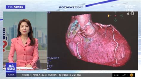[황선숙의 건강한 아침] 갑작스런 흉통 심근경색