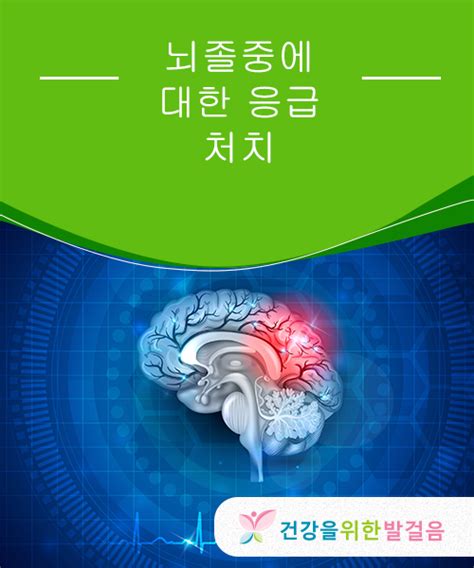 뇌졸중에 대한 응급 처치 응급 처치 인공호흡 심폐소생술