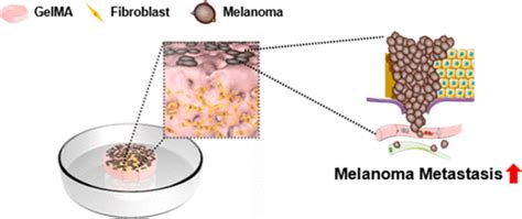 Evaluation Of The Effect Of Fibroblasts On Melanoma Metastasis Using A