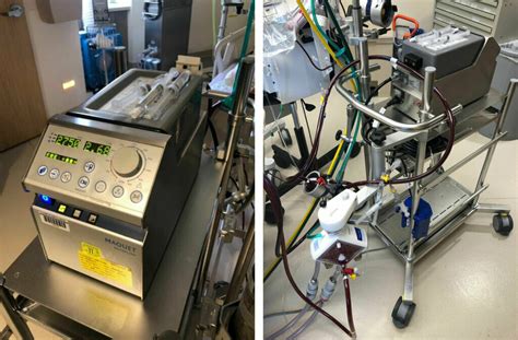 Ecmo Machine Maquet