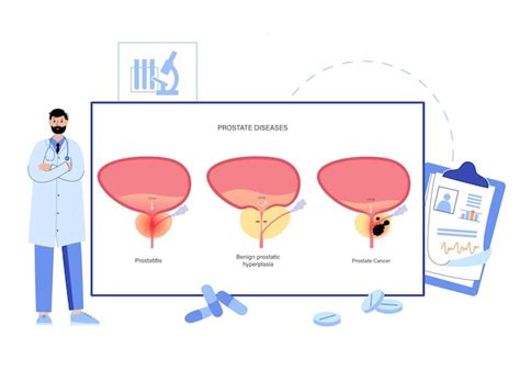 Premium Vector Man Reproducive System Problems