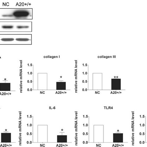 A20 Overexpression Inhibited Lx 2 Cells Activation And Attenuated