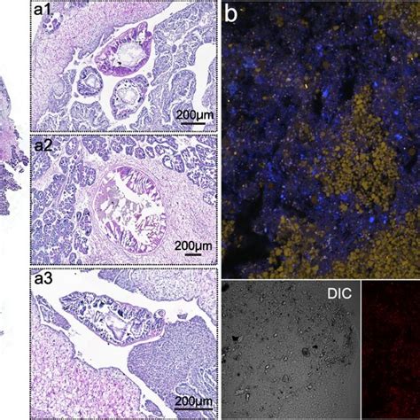 Histology And Fluorescent In Situ Hybridisation Analysis Of The