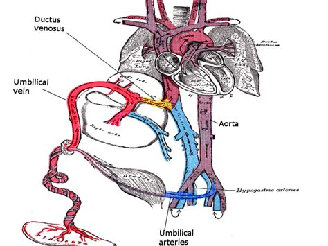 Umbilical Artery Catheterization