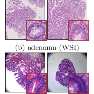 Examples Of The Inter Domain Discrepancy Between WSIs A C And MSIs Download Scientific