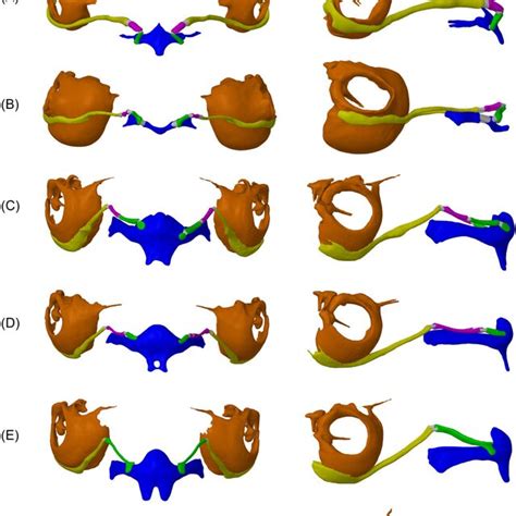 Stylohyal Auditory Bulla Articulation From Ldcfm And Hdcnb Download Scientific Diagram