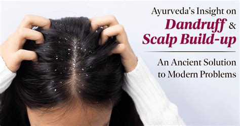 Dandruff And Scalp Build Up Ayurvedic Solution To Modern Problems