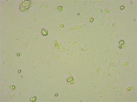 High Pressure Homogenizer Yeasts Cell Disruption Lysis