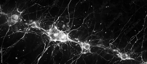 Apical Dendrite Structure Of Cortical Pyramidal Neurons With Spines And