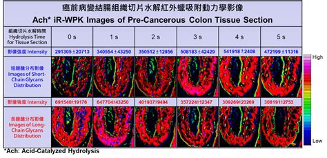 同步輻射紅外顯微術在癌症篩檢及慢性腎臟病之預後預測及其治療評估 Future Tech Pavilion Futex