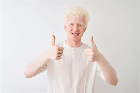 젊은 Albino 금발 남자 캐주얼 티셔츠 위에 서 고립 된 흰색 배경 성공 표지판 손으로 긍정적인 제스처를 하 고 엄지 손가락 미소와 행복 쾌활한 표정과 승자 제스처 T