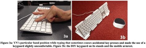 Better Typing With Keyboard Assistive Technology Kpr Blog