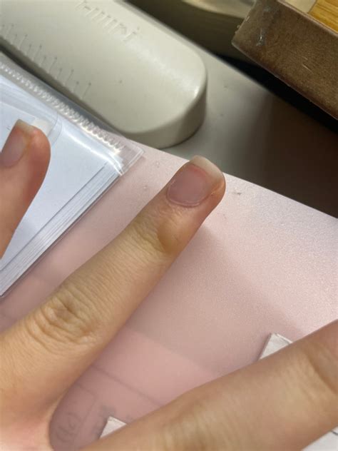 손가락 굳은살 없애는법 지식in