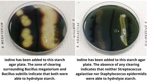 Starch Hydrolysis Test Principle Procedure Results