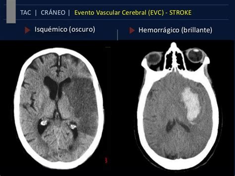 Neurotac Anatomia Basica Dr Mendoza Y Job