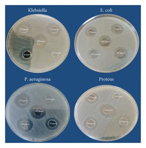 Bacterial Growth Inhibition Zone Achieved In The Agar Well Diffusion Download Scientific