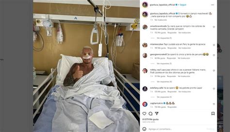 Espera Su Retorno A La Seria A Gianluca Lapadula Se Operó La Nariz Y