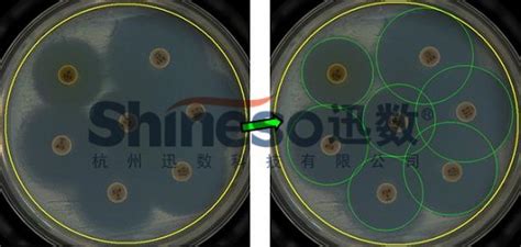 抗生素效价测定