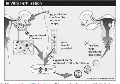 In Vitro Fertilization Diagram