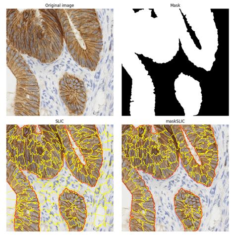 Maskslic Slic Skimage Scikit Image