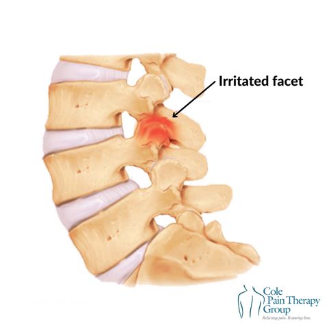 Facet Joint