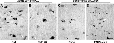 Photomicrographs Illustrating The Opposite Patterns Of C Fos Mrna