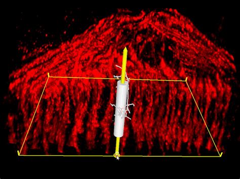 Video Analyzing Dendritic Morphology In Columns And Layers