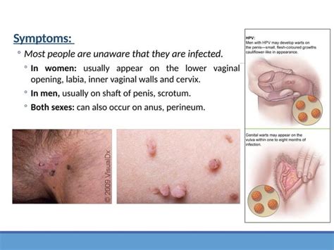Microbiology Of Sexually Transmitted Infections Ppt
