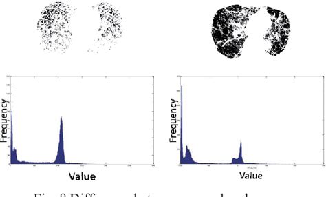 Figure 8 From Severity Analysis Of Pulmonary Emphysema Based On The