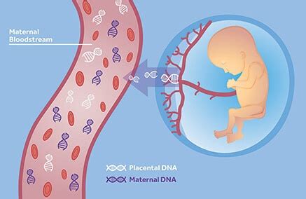 Non Invasive Tests For Trisomy DNA Forenics Laboratory