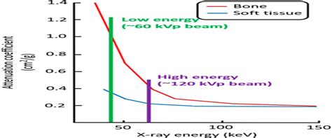 Dual Energy Subtraction Chest Radiography Application In Ca