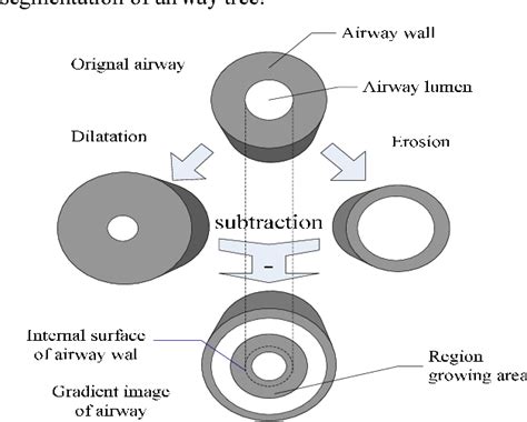 Figure 1 From Mgrg Morphological Gradient Based 3d Region Growing Algorithm For Airway Tree