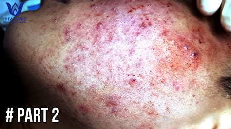 Relax Every Day With Hhv Clinic Hiền Vân Spa 05 Part 2 Youtube