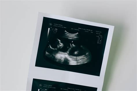 Dwunasty tydzień ciąży co się zmienia w organizmie matki i dziecka Hi Gen Centrum