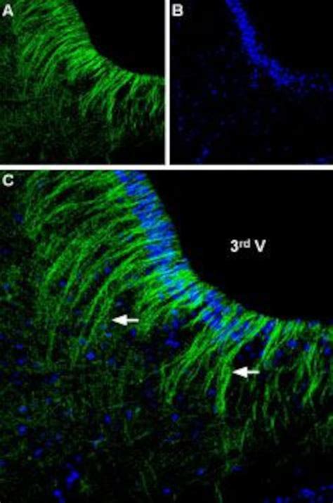 Alpha 2a Adrenergic Receptor Extracellular Polyclonal Antibody Aar