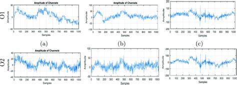 Eeg Based Hypo Vigilance Detection Using Convolutional Neural Network Abstract Europe Pmc