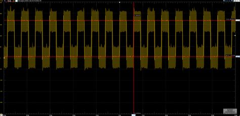 esp32 eeg