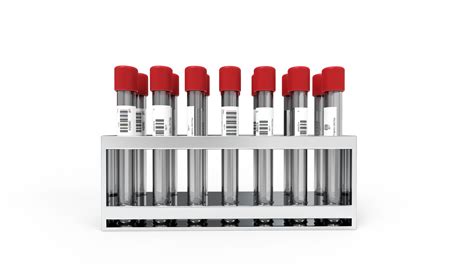 Provette Nice Group Slime Doctor Totenkopf Kleber Aktivator Kinder